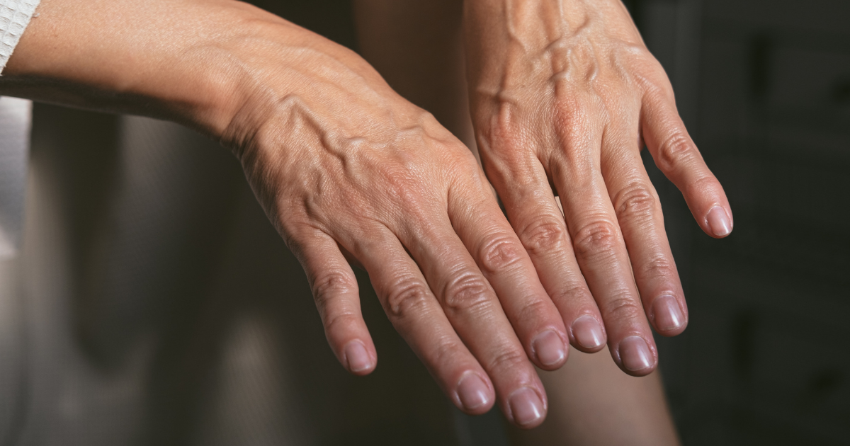 How to Make Hands Look Younger | Reverse the Signs of Aging